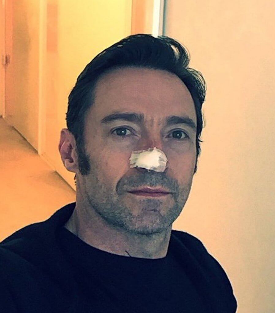 Skin Cancer Survivor Hugh Jackman Looking Dapper