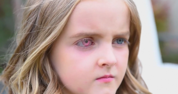 Girl, 8, Proudly Shows Off Her Pink Sparkly 'Superhero' Prosthetic Eye