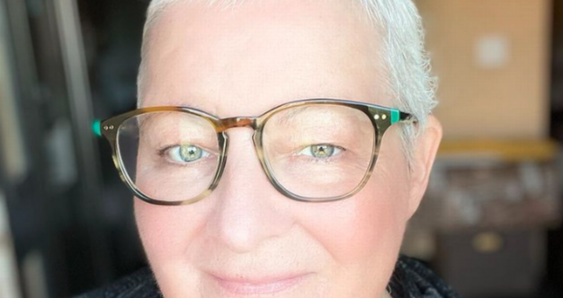 Ovarian Cancer Survivor Comedian, 61, is Trolled on Socials for Bald Head