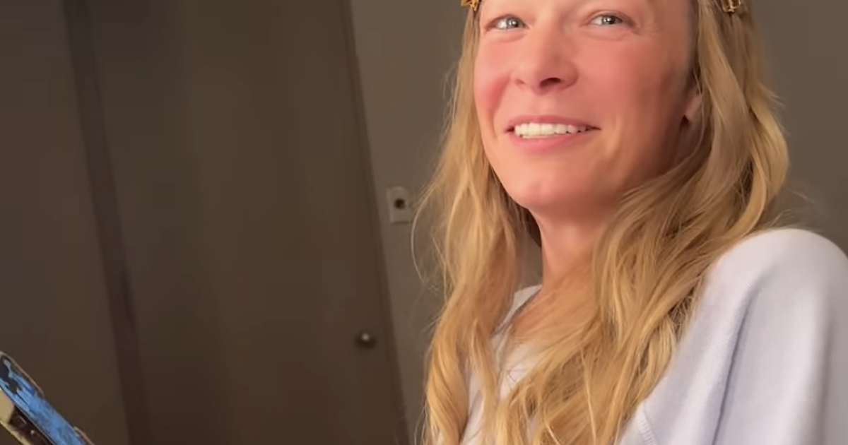 Singer Leann Rimes Reaches Milestone Despite Living With Psoriasis