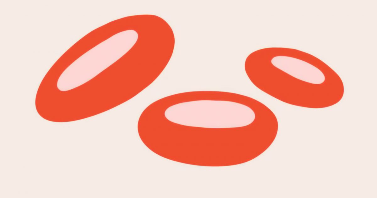 The Latest in Managing Anemia for Patients With Myelodysplastic ...